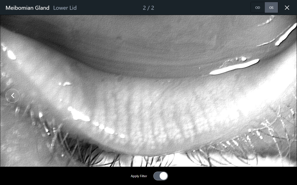 ZEISS EyeCare Network