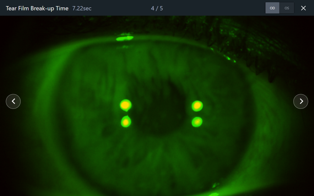 ZEISS EyeCare Network